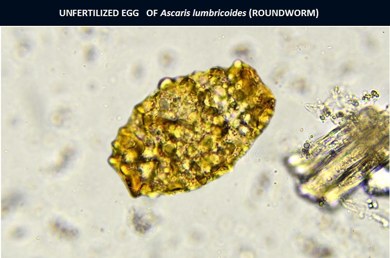 Unfertilized Egg of Ascaris Lumbricoides