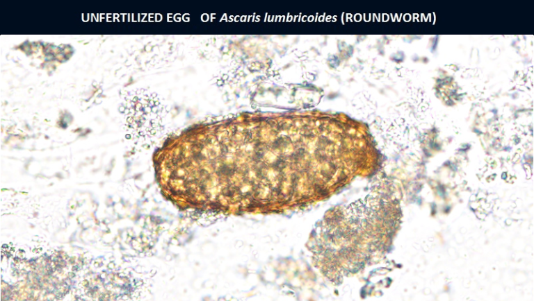 Ascaris lumbricoides (Roundworm) Eggs: Morphology, Characteristics and ...