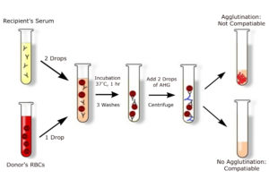 Cross Matching : Types, Principle, Procedure and Interpretation