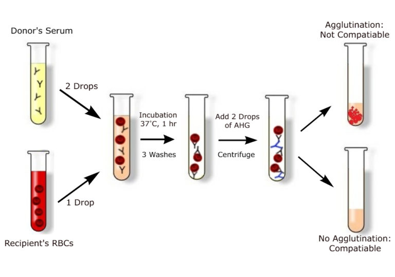 Cross Matching : Types, Principle, Procedure and Interpretation