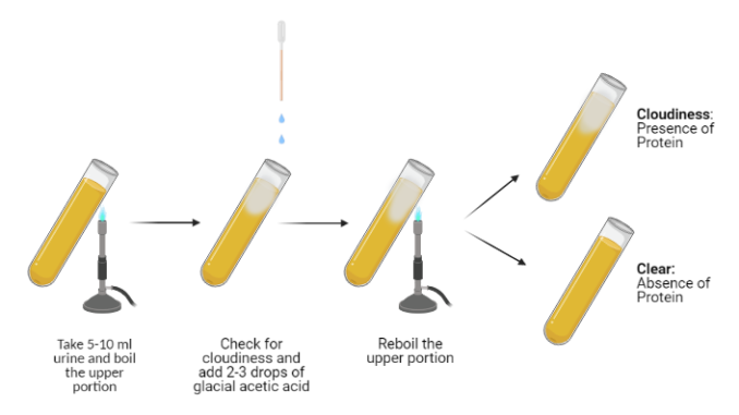 Heat and Acetic Acid Test for Proteinuria: Principle and Procedure