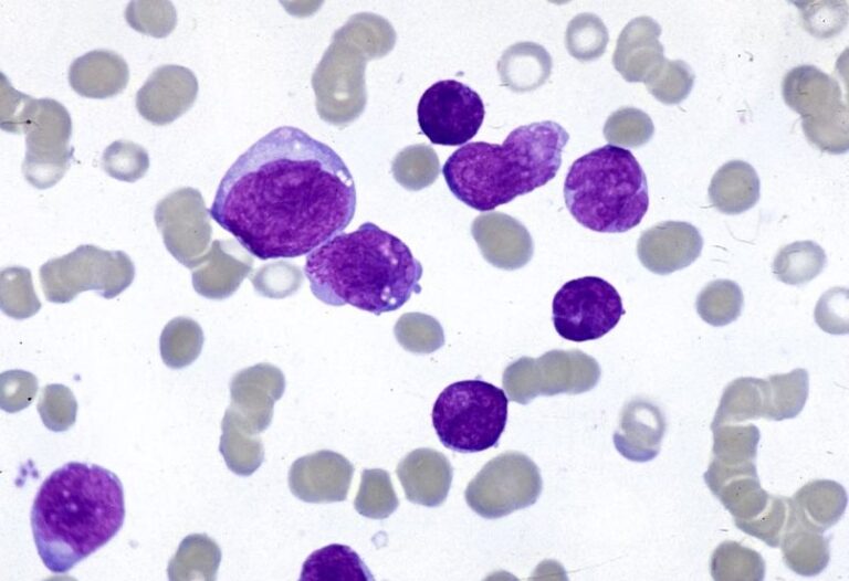 May Grunwald-Giemsa Stain: Principle, Preparation and Procedure