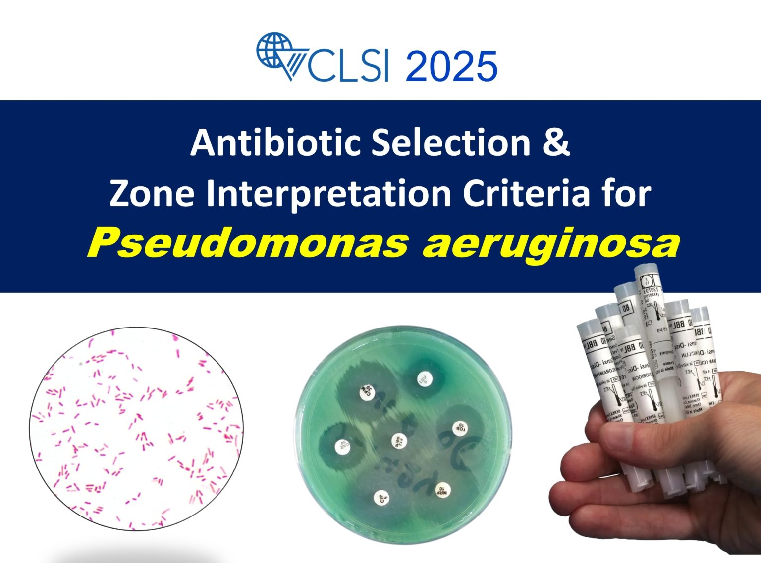 Folin-Wu Method For Estimation of Blood Glucose